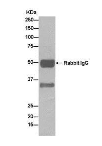 Anti-SNAP-beta antibody [EPR15046(B)] - N-terminal (ab184563) | Abcam
