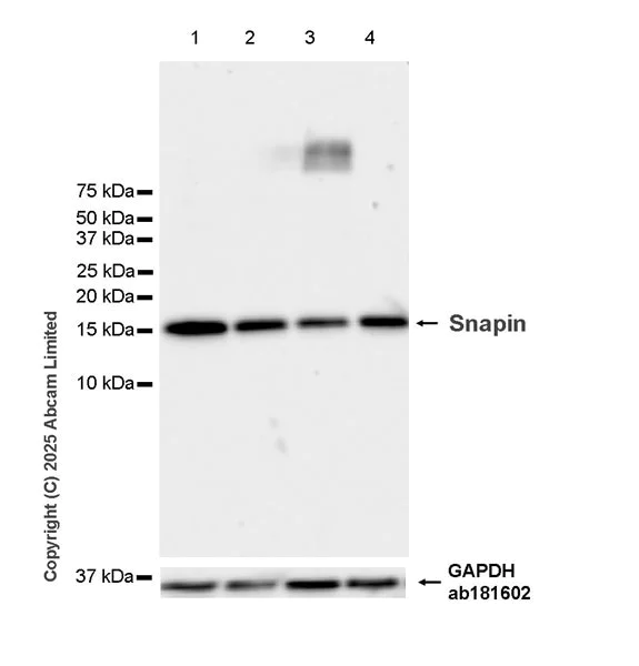 Anti-Snapin antibody [RM2091] (ab324947) | Abcam中文官网