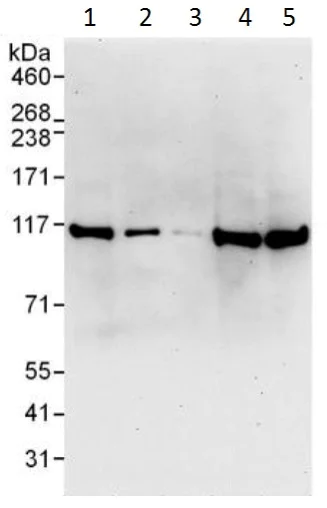 Anti-SND1 antibody (ab225620) | Abcam