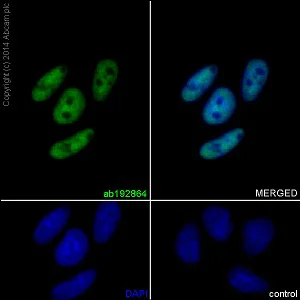 Anti-SNF5/SMARCB1 antibody [EPR12014-77] KO tested (ab192864) | Abcam