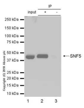 Anti-SNF5/SMARCB1 antibody [EPR20189] (ab222519) | Abcam