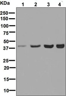 Anti-SNF5/SMARCB1 antibody [EPR6966] (ab126734) | Abcam