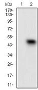 Somatostatin Receptor 3/SSTR3抗体[7H8E5] (ab201952)| Abcam中文官网