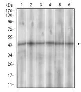Somatostatin Receptor 3/SSTR3抗体[7H8E5] (ab201952)| Abcam中文官网
