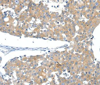 Anti-Somatostatin Receptor 3/SSTR3 antibody (ab198851) | Abcam