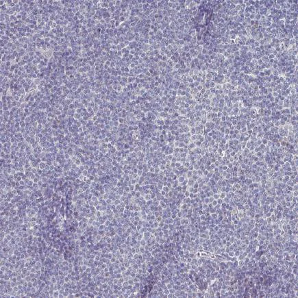 Anti-SOX11 antibody [CL0143] (ab242203) | Abcam