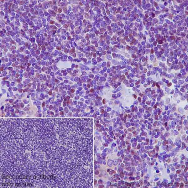 Anti-SOX11 antibody [EPR20457] (ab229185) | Abcam