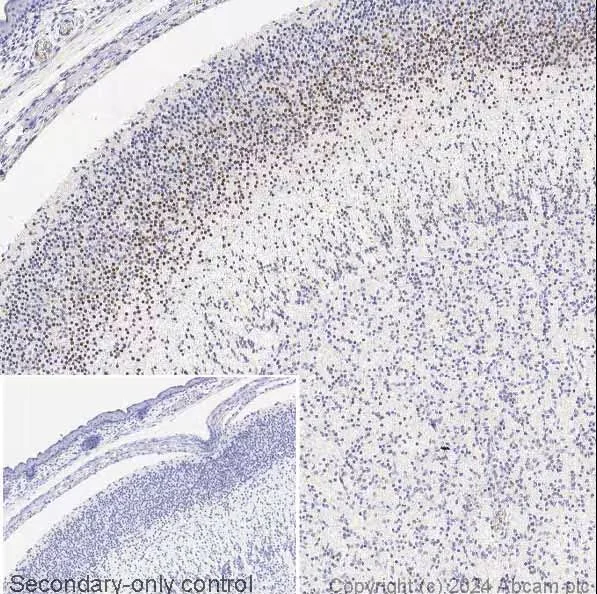 Anti-SOX5 antibody (ab94396) | Abcam