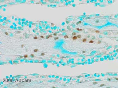 Sp7 / Osterix抗体 (ab22552)| Abcam中文官网