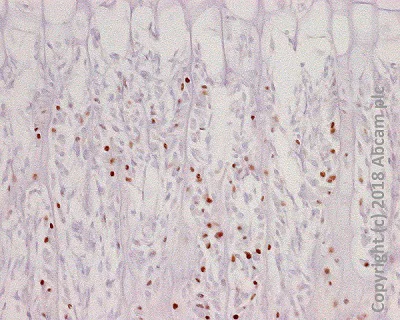 Sp7 / Osterix抗体 (ab22552)| Abcam中文官网