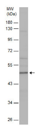Sp7 / Osterix抗体[EPR21034] - BSA and Azide free (ab227820)| Abcam中文官网