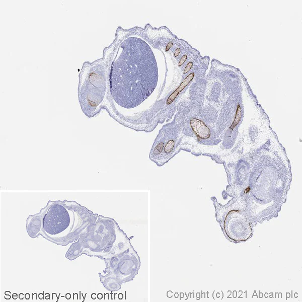 Sp7 / Osterix抗体[EPR21034] (ab209484)| Abcam中文官网