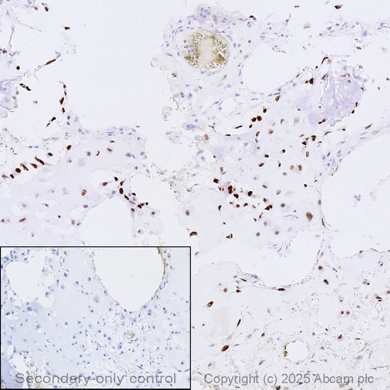 Sp7 / Osterix抗体[EPR21034] - BSA and Azide free (ab227820)| Abcam中文官网