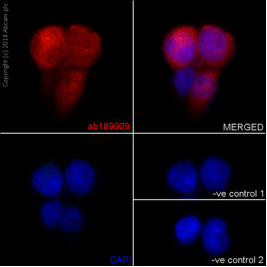 Anti-Spa-1 antibody [EPR14134] (ab189929) | Abcam