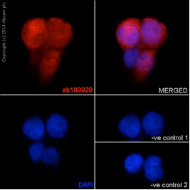 Anti-Spa-1 antibody [EPR14134] (ab189929) | Abcam