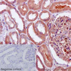 Anti-Spa-1 antibody [EPR14134] (ab189929) | Abcam