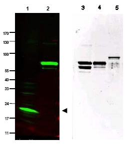 Anti-SPANX antibody (ab47252) | Abcam
