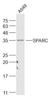 Anti-SPARC antibody (ab203284) | Abcam