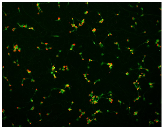 Spinal Motor Neuron - Human iPSC derived cells (Male, WC-30) (ab315364 ...