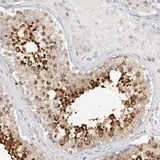 Anti-SPINK2 antibody (ab121890) | Abcam