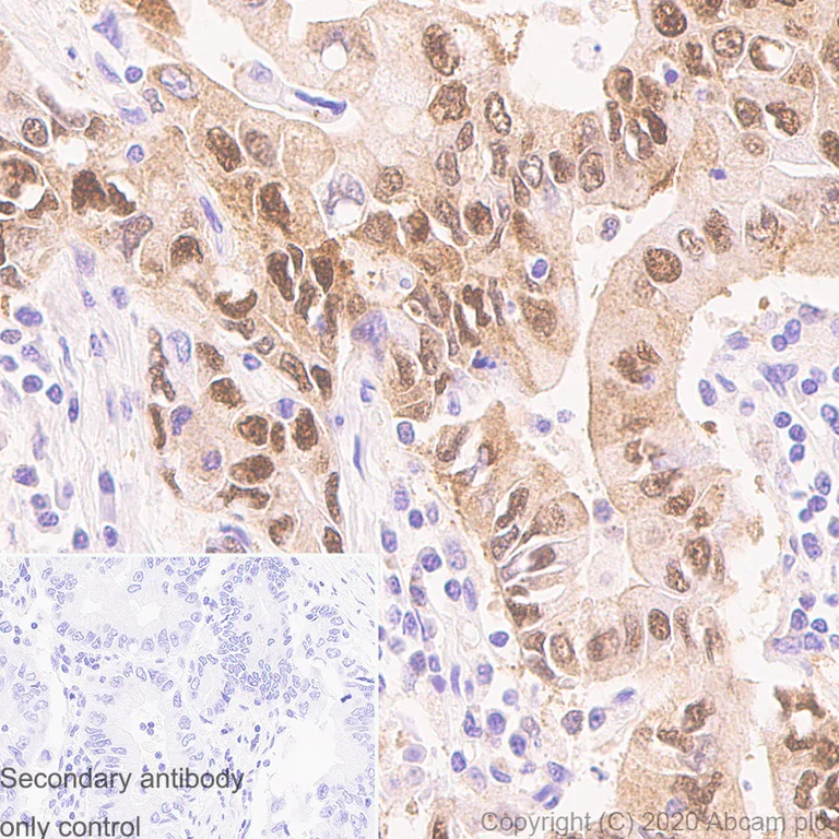 Anti-SQSTM1 / p62 antibody [3/P62 LCK LIGAND] - BSA and Azide free ...