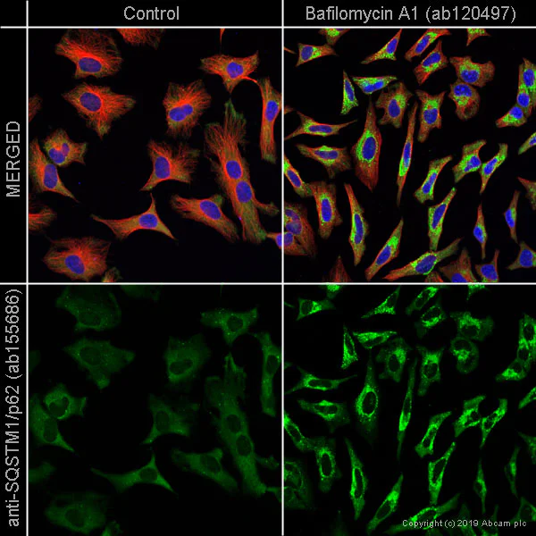 SQSTM1 / p62抗体- Autophagosome Marker (ab155686)| Abcam中文官网