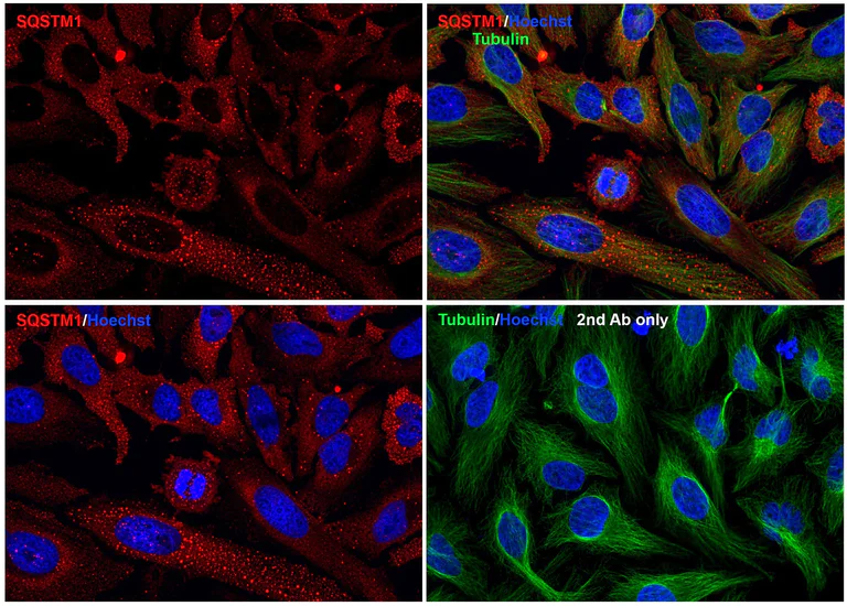 Anti-SQSTM1/p62 antibody - rabbit polyclonal (ab91526) | Abcam