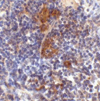 SQSTM1 / p62抗体- Autophagosome Marker (ab91526)| Abcam中文官网
