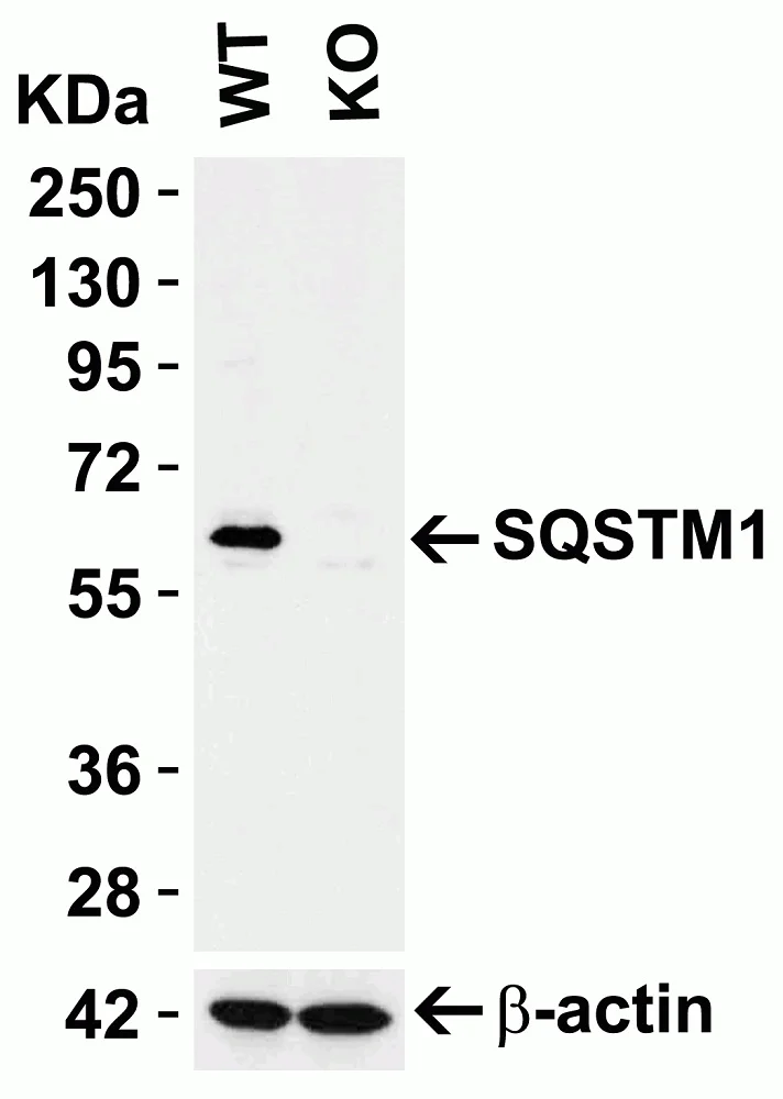 SQSTM1 / p62抗体- Autophagosome Marker (ab91526)| Abcam中文官网
