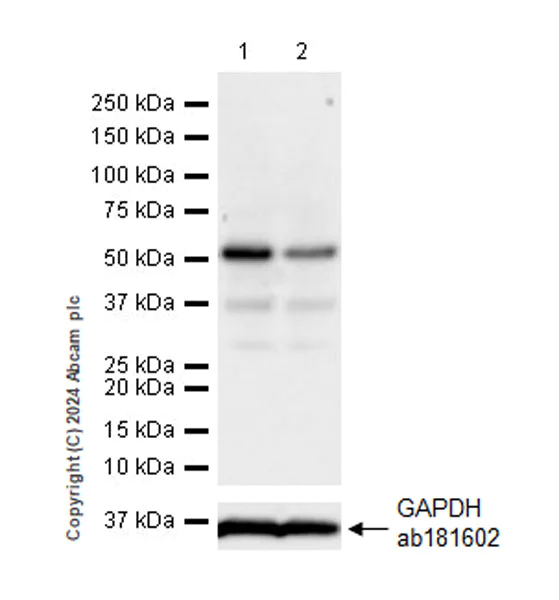 Squalene Epoxidase抗体[EPR29195-89] (ab317628)| Abcam中文官网