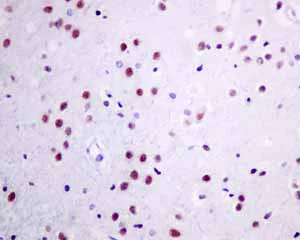 SR protein repeat/SRSF6抗体[EPR9231] (ab140623)| Abcam中文官网