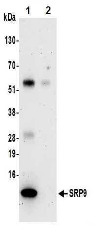 Anti-SRP9 antibody (ab241989) | Abcam