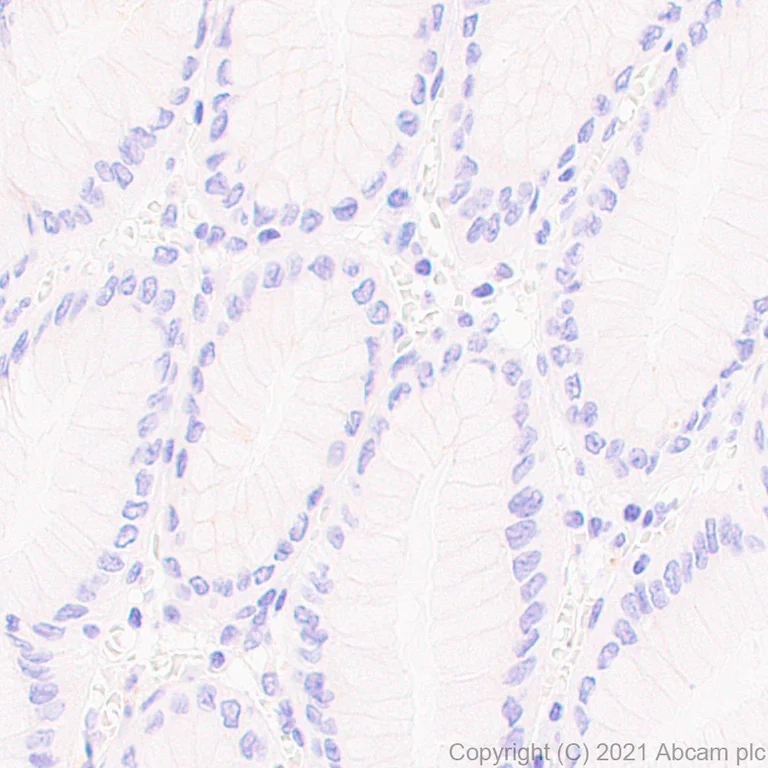 Anti-SS18-SSX Fusion Protein antibody [EPR24159-81] (ab254406) | Abcam