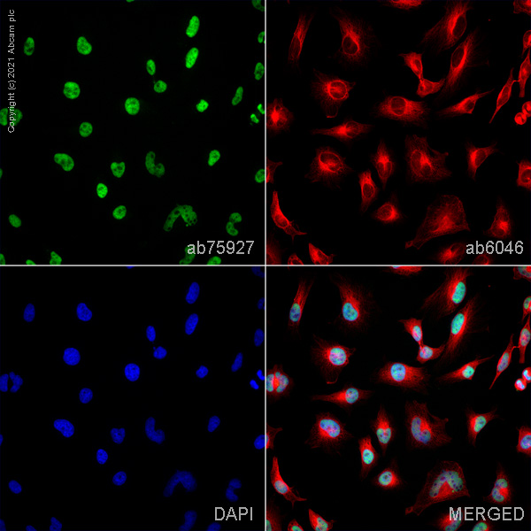 Anti-SSB antibody [mAbcam75927] (ab75927) | Abcam
