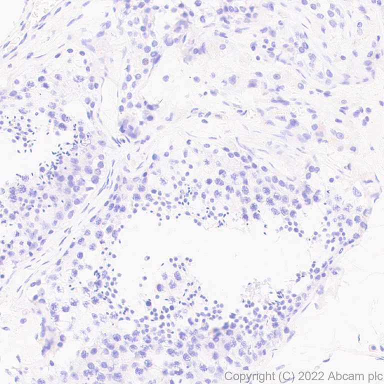 Anti-ST14 antibody [EPR26785-94] (ab307599) | Abcam