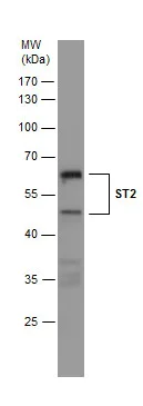 Anti-ST2 antibody (ab228543) | Abcam