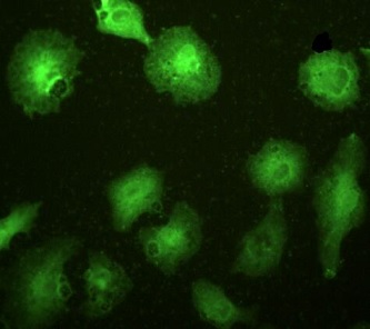 Anti-ST2 antibody (ab233433) | Abcam