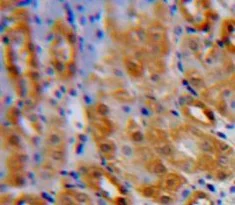 Anti-ST2 antibody (ab233433) | Abcam