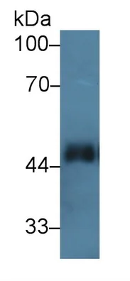 Anti-ST2 antibody (ab233433) | Abcam