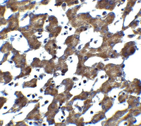 Anti-ST2 antibody - BSA free (ab25877) | Abcam