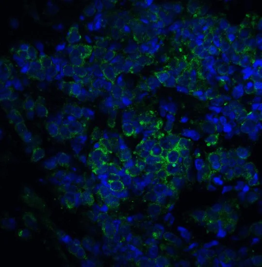 Anti-ST2 antibody - BSA free (ab25877) | Abcam