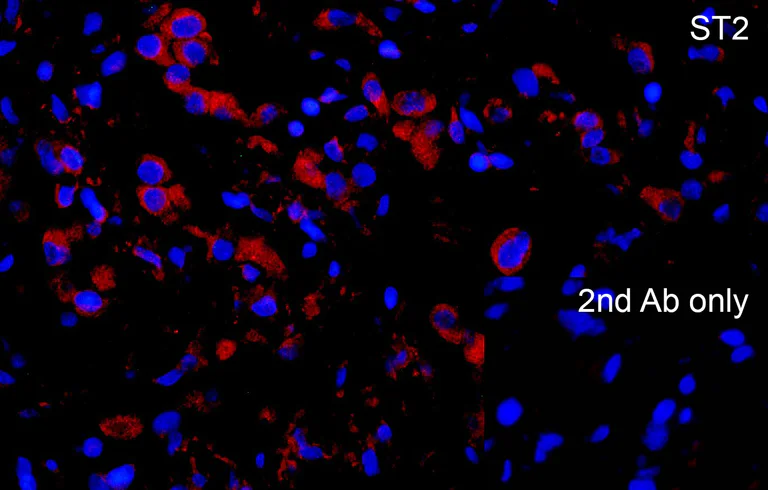 Anti-ST2 antibody - BSA free (ab25877) | Abcam