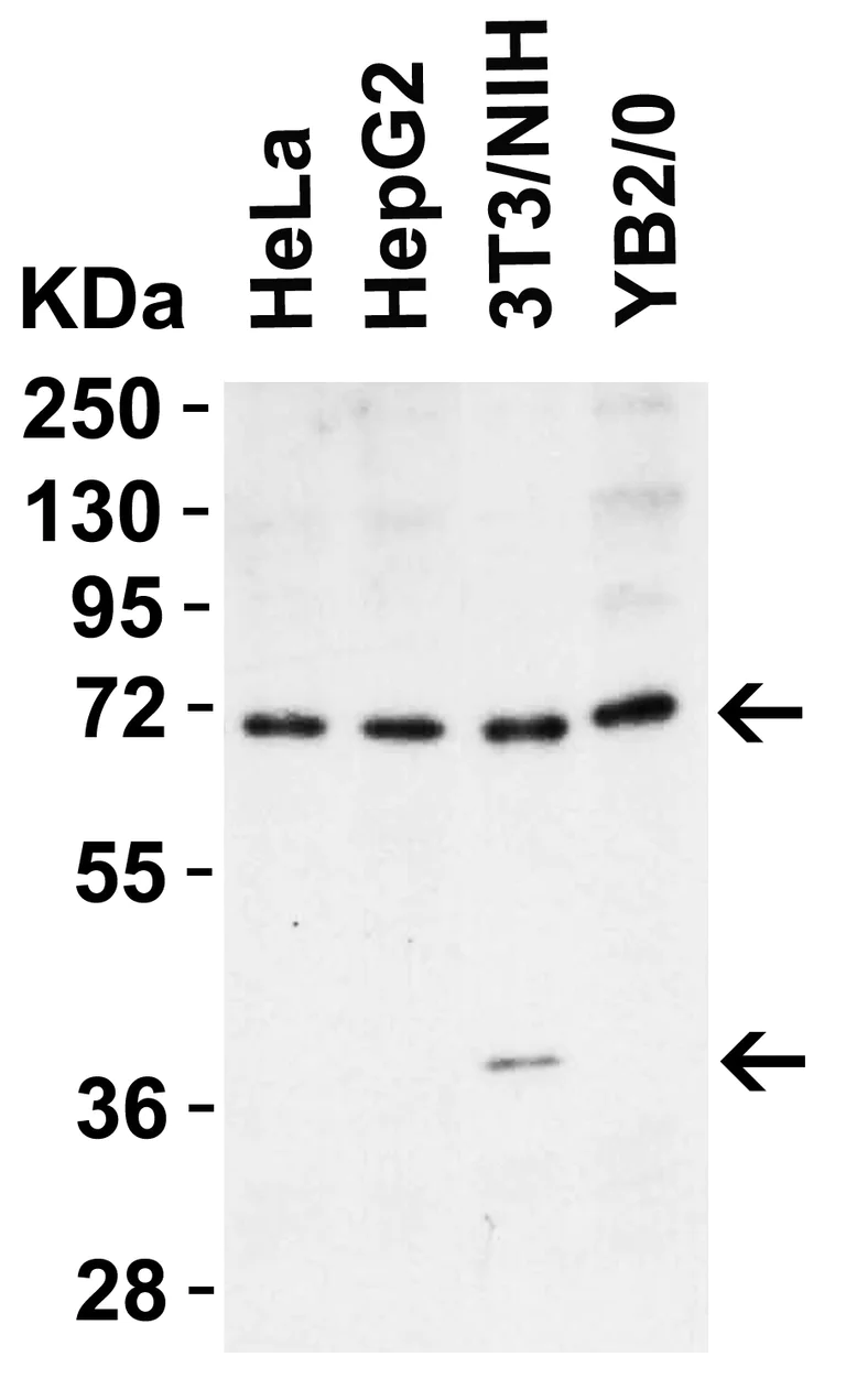Anti-ST2 antibody - BSA free (ab25877) | Abcam