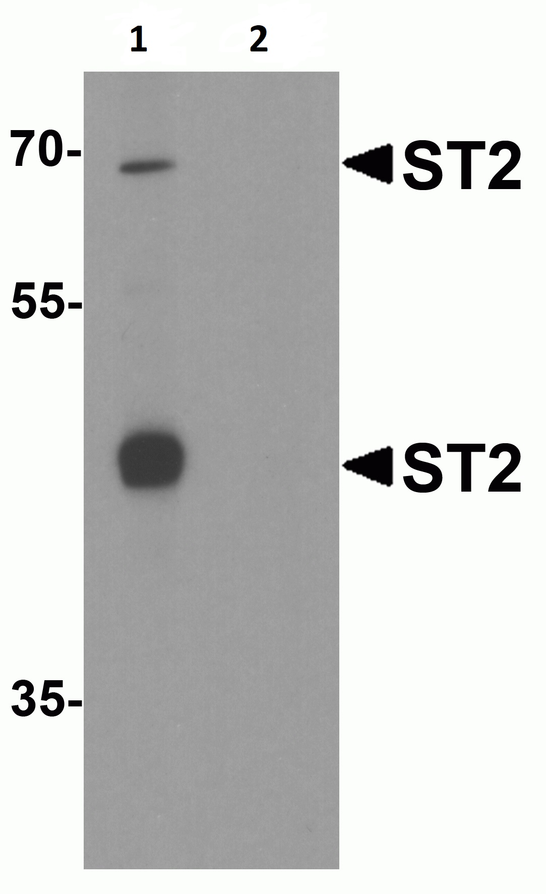 Anti-ST2 antibody - BSA free (ab25877) | Abcam