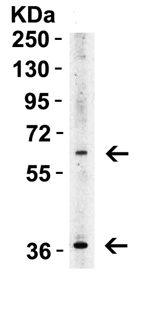 Anti-ST2 antibody - BSA free (ab25877) | Abcam