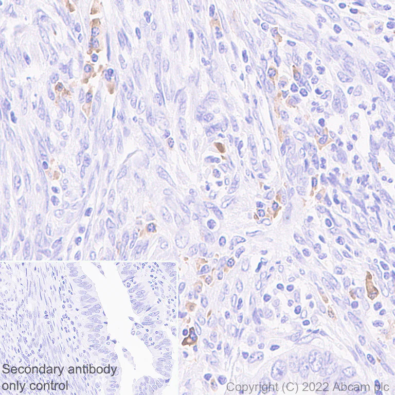 Anti-ST2 antibody [EPR25264-147] (ab291071) | Abcam