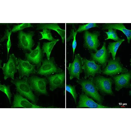 Anti-STAM antibody [HL1635] (ab317097) | Abcam