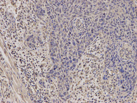 Anti-StAR antibody (ab180804) | Abcam