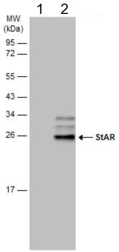 Anti-StAR antibody (ab96637) | Abcam