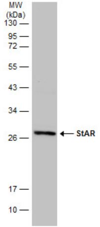 Anti-StAR antibody (ab96637) | Abcam